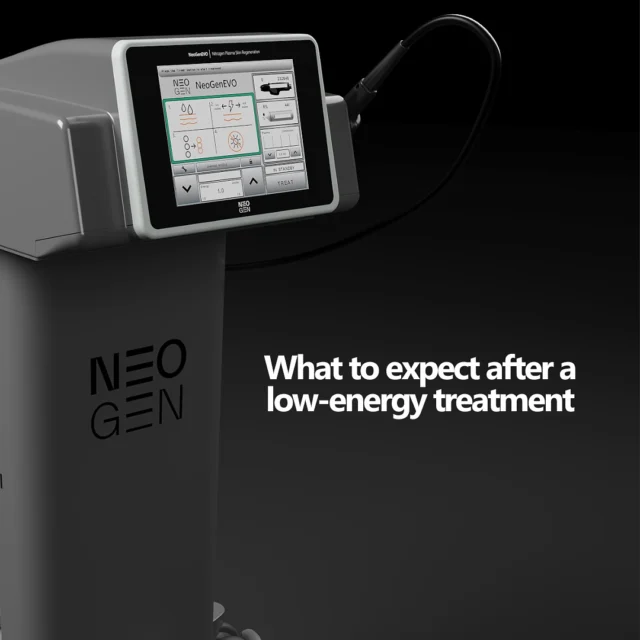 Nitrogen Plasma Skin Regeneration | NeoGen UK